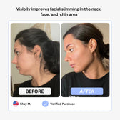 TRUE BEAUTY GLOW DEVICE | The Official Store