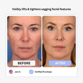 TRUE BEAUTY GLOW DEVICE | The Official Store