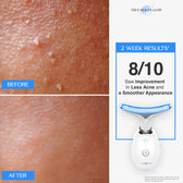 TRUE BEAUTY GLOW DEVICE | The Official Store